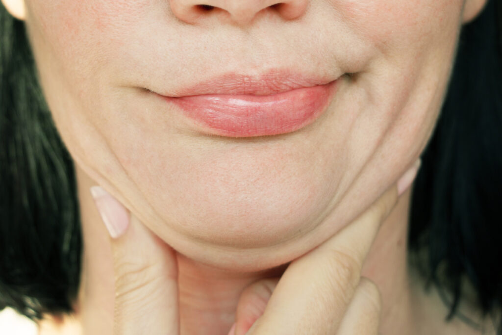 Come eliminare il doppio mento con e senza la chirurgia? - FisioCareLab